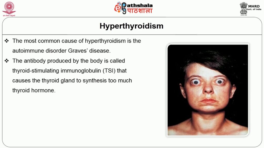 Endocrine Disorders and Their Symptoms