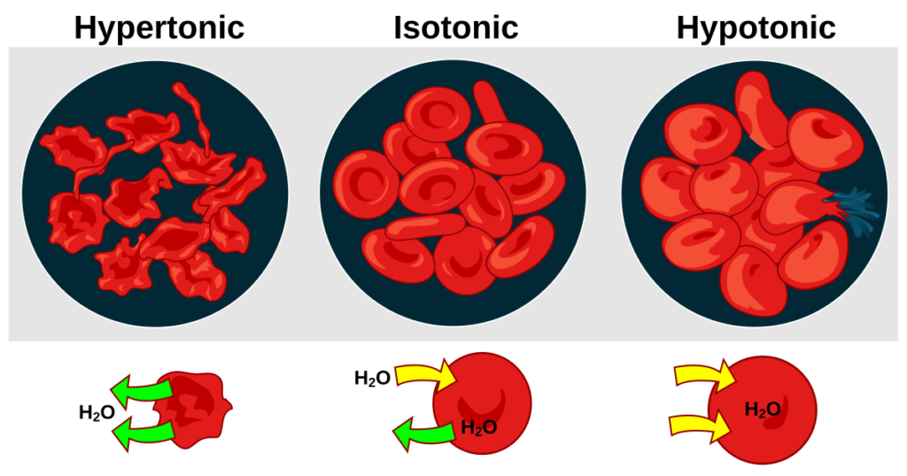 Examples of Hypertonic vs Hypotonic Solutions Explained